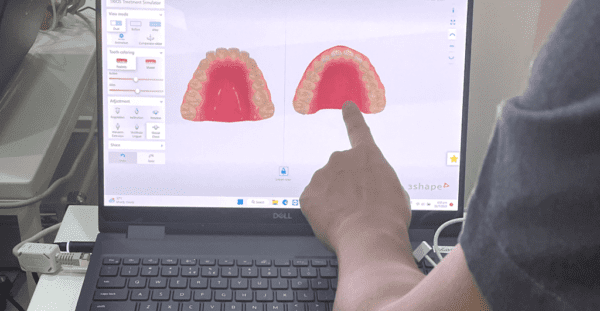 Cosmetic Dentistry Smile Makeover | Trusted Dental Clinic - Brightside