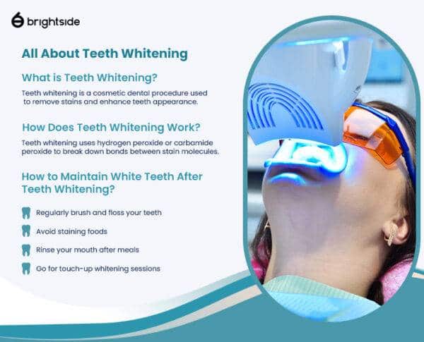 Dental Teeth Whitening Treatment Process From A to Z